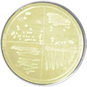 Luria-Bertani (LB) Agar Plates, w/ AMP-100 | Microbiological Media ...